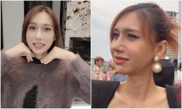 Lynk Lee lên tiếng về chiếc mũi sửa 8 lần càng trông như "phù thuỷ ...